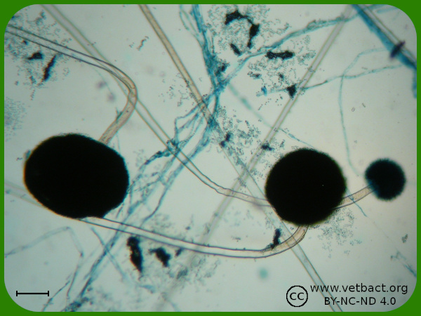 aspergillus conidia under microscope