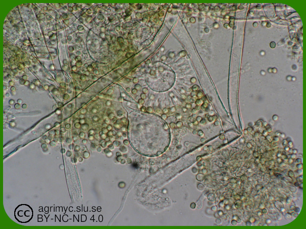 Aspergillus Parasiticus
