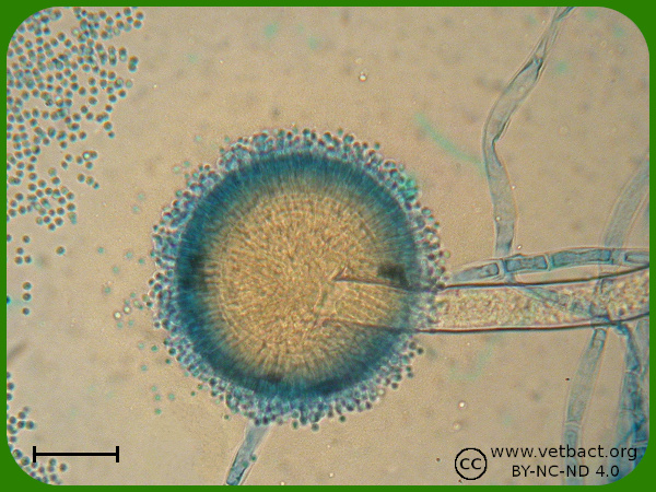 aspergillus conidia